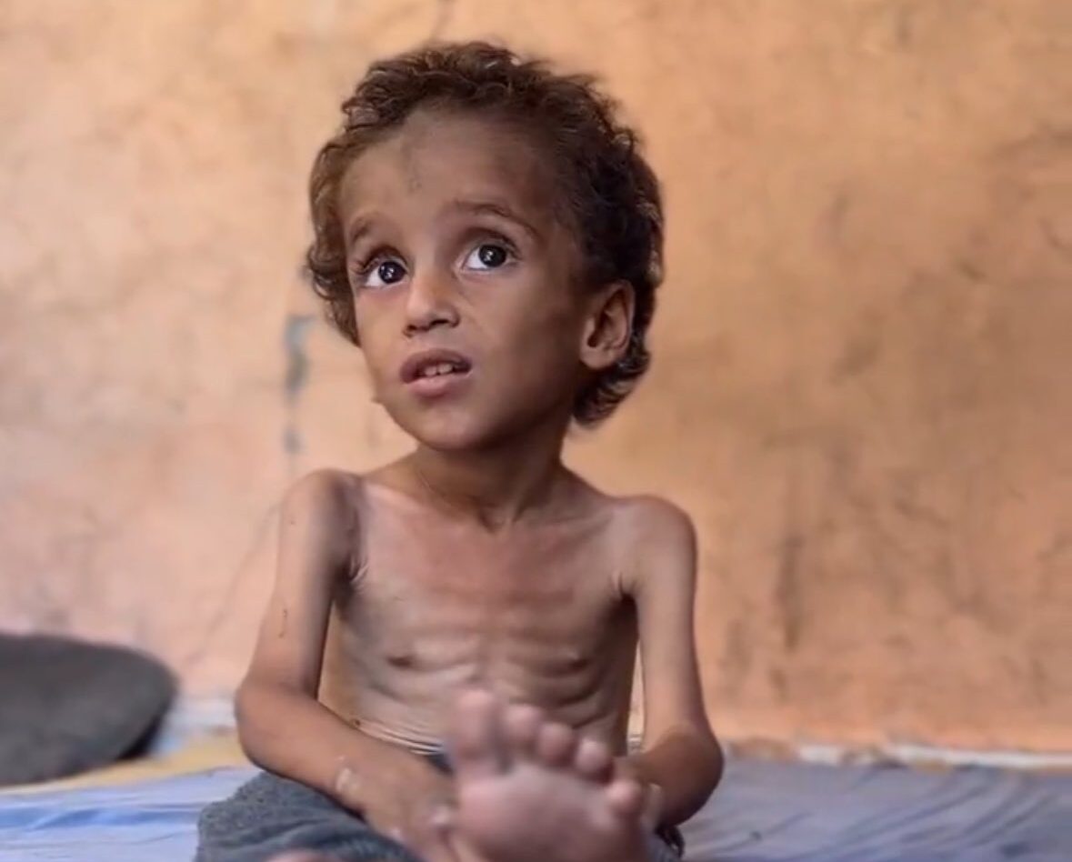 News agencies issue joint statement on Gaza hunger crisis - Meghalaya ...